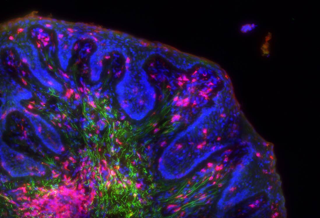 Leading Light: One Microscope, Lots Of Nobel Prize Winners | GE News